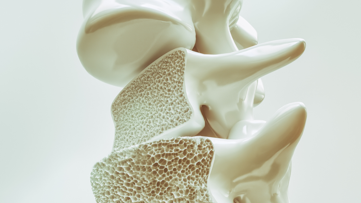 What Is a DEXA Scan? Bone Density Test Explained – sōlaria biō